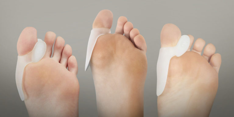 The Best Bunion Protectors - Foot Health Hub